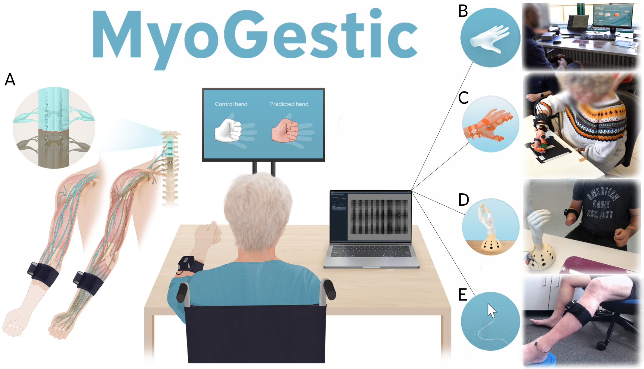 MyoGestic - Open-Source, Adaptive EMG Interface for Restoring Motor ...